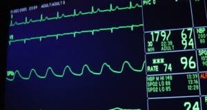 Yale Swallow Protocol Archives - Dysphagia Cafe